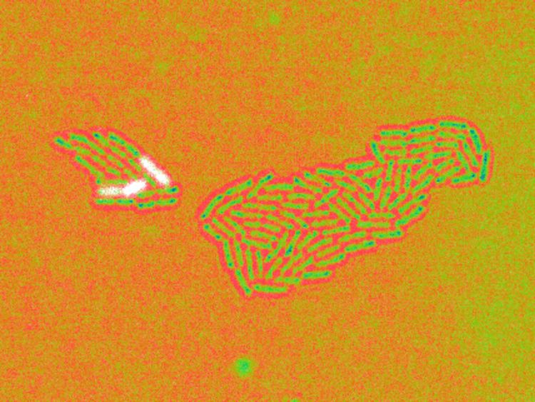 TWINCORE - Interface between basic research and clinical practice